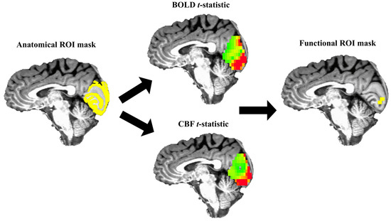 Anatomical Automatic Labeling Manual Arts - rangfloor