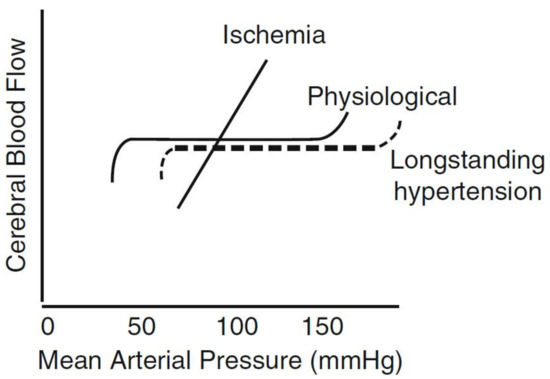 Blood Pressure Gradients in the Brain: Their Importance to ...