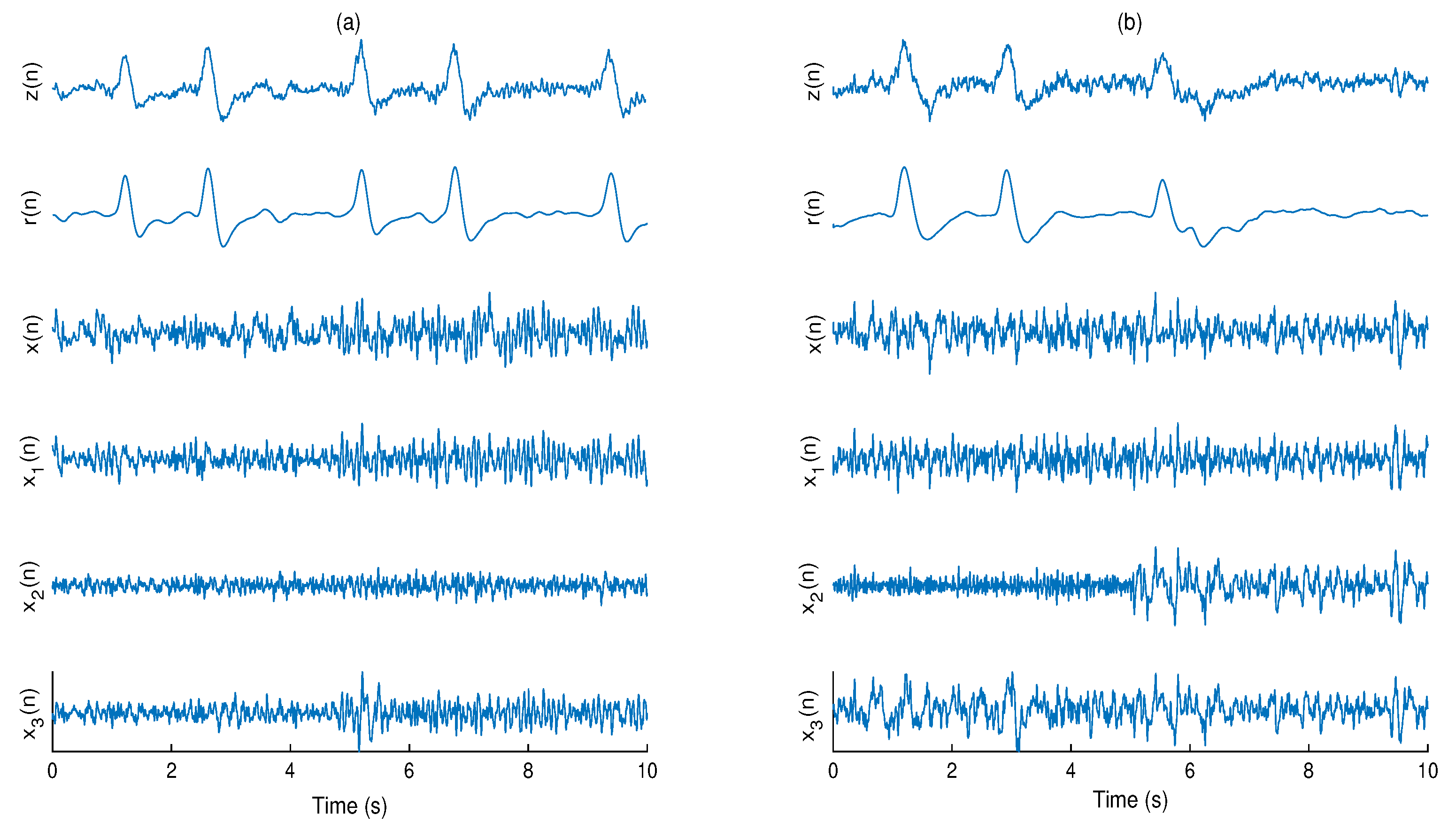 Low Complexity Automatic Stationary Wavelet Transform for Elimination of Eye Blinks from EEG