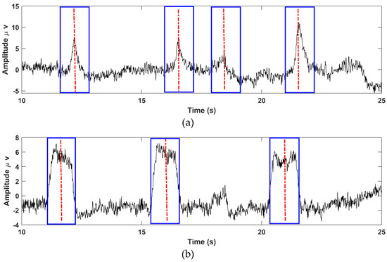 Improved EOG Artifact Removal Using Wavelet Enhanced Independent ...