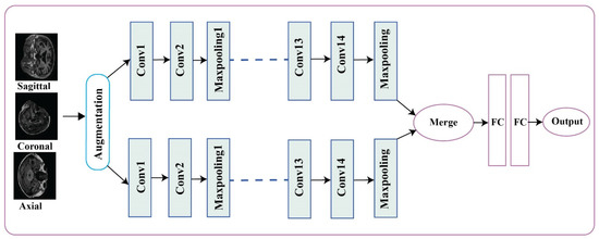 A Deep Siamese Convolution Neural Network for Multi-Class Classification of Alzheimer Disease