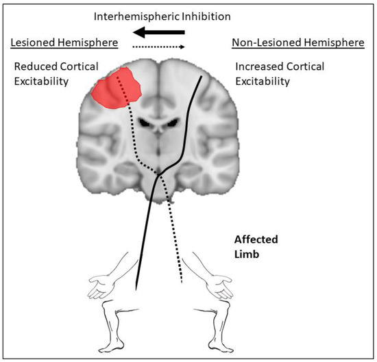 Transcranial Direct Current Stimulation to Facilitate Lower Limb ...
