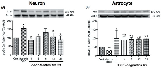 Expression and Distribution Pattern of Pnn in Ischemic Cerebral Cortex ...