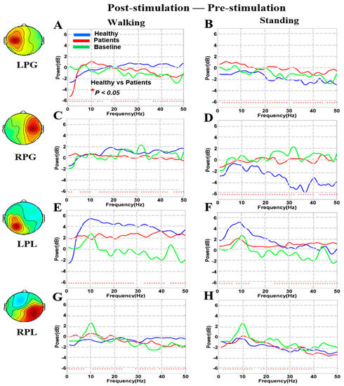 Noisy Galvanic Vestibular Stimulation (Stochastic Resonance) Changes ...
