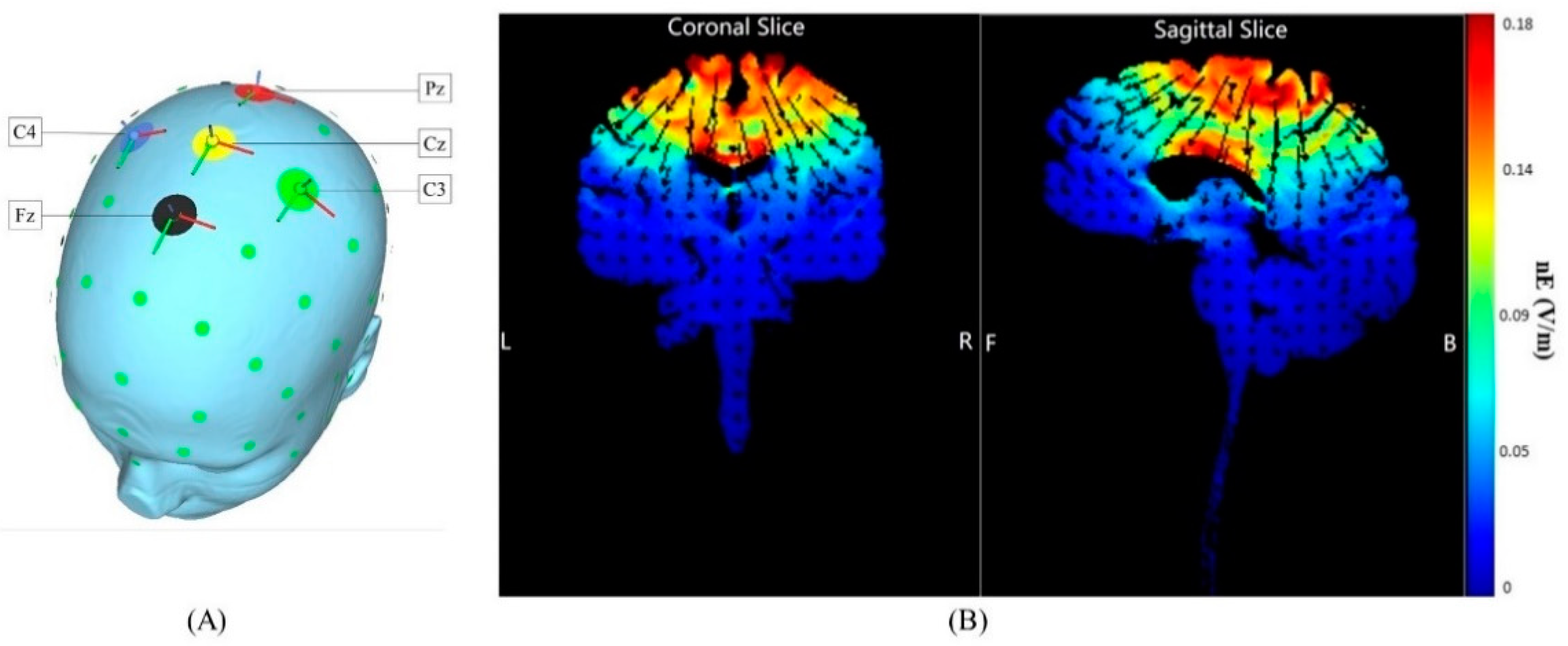 Effects of Combining High-Definition Transcranial Direct Current ...