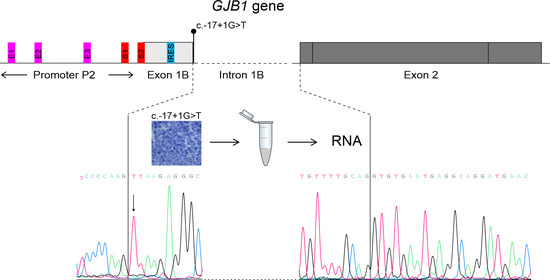Brain Sciences | Free Full-Text | Aberrant Splicing in GJB1 and the ...