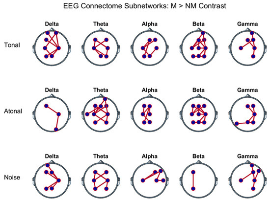Brain Sciences | Free Full-Text | Modifications in the Topological ...