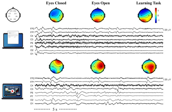Brain Sciences | Free Full-Text | EEG-Based Tool for Prediction of ...