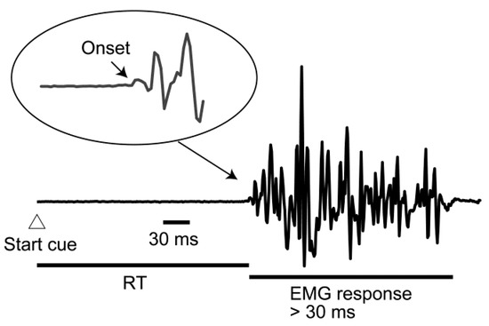 Common Motor Drive Triggers Response of Prime Movers When Two Fingers ...