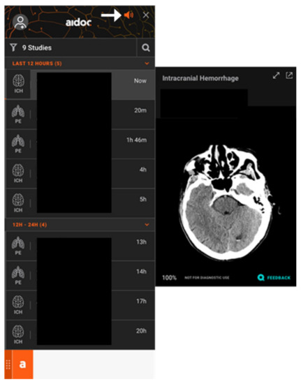Implementation of Machine Learning Software on the Radiology Worklist ...
