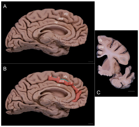 Brain Sciences | Free Full-Text | Revisiting the Morphology and ...