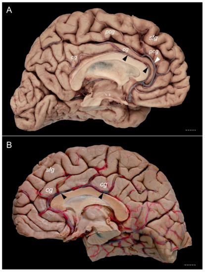Brain Sciences | Free Full-Text | Revisiting the Morphology and ...