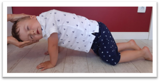 Primitive Reflex Activity in Relation to Motor Skills in Healthy ...