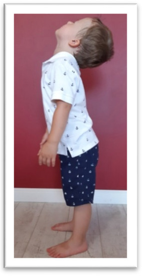 Primitive Reflex Activity in Relation to Motor Skills in Healthy ...