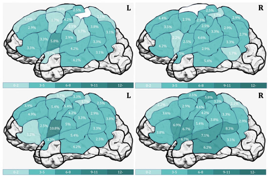 Brain Sciences | Free Full-Text | Bihemispheric Navigated Transcranial ...