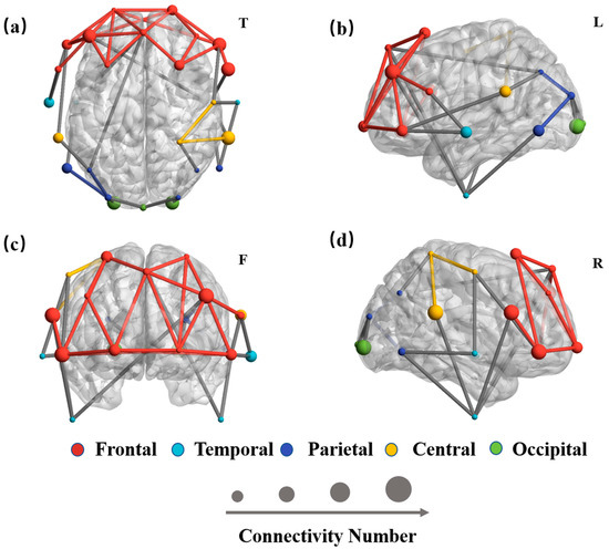 On the Specificity and Permanence of Electroencephalography Functional ...