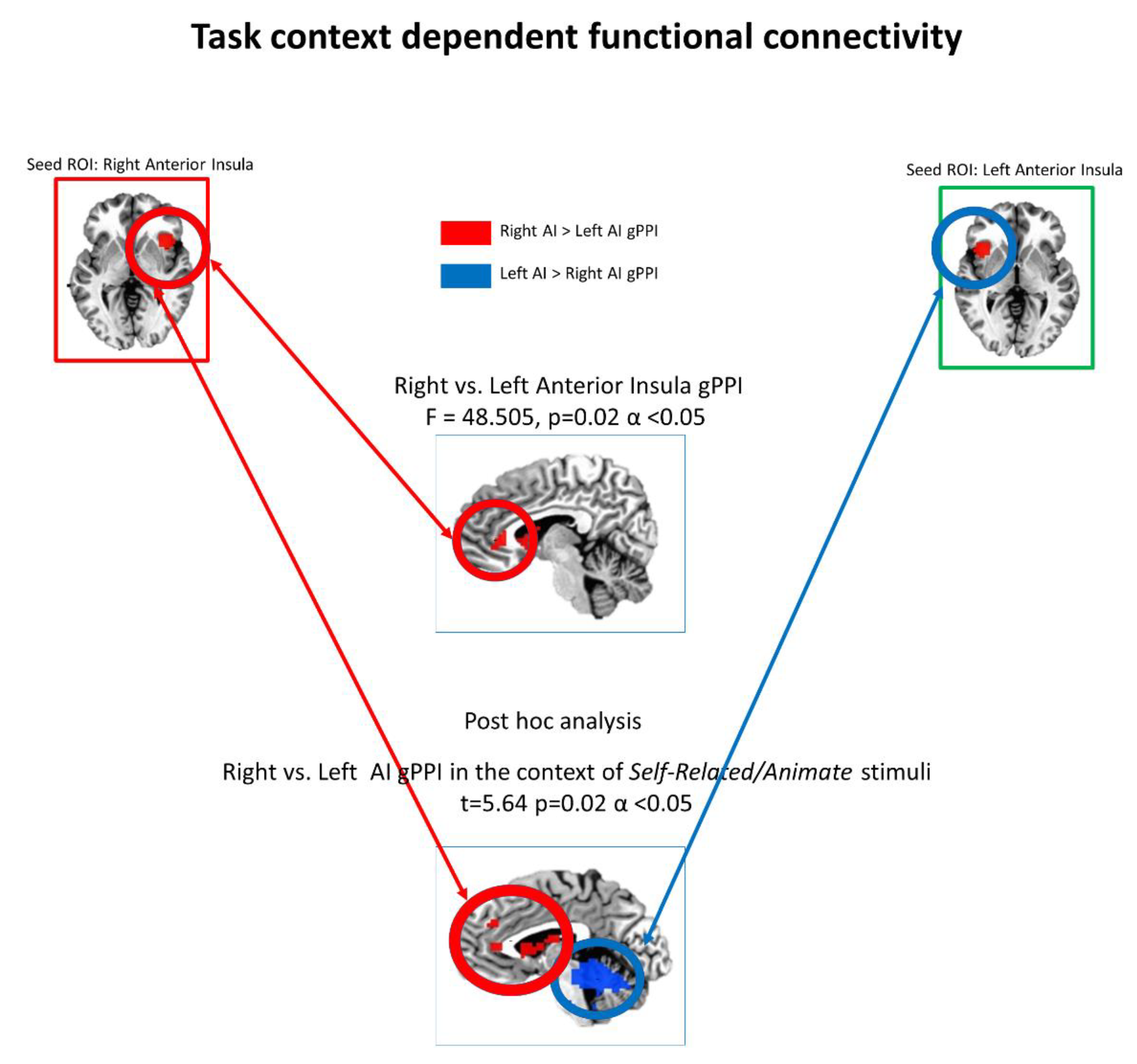 The Self and Its Right Insula—Differential Topography and Dynamic of ...