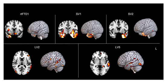 Brain Sciences | Free Full-Text | Treatment for Anomia in Bilingual ...