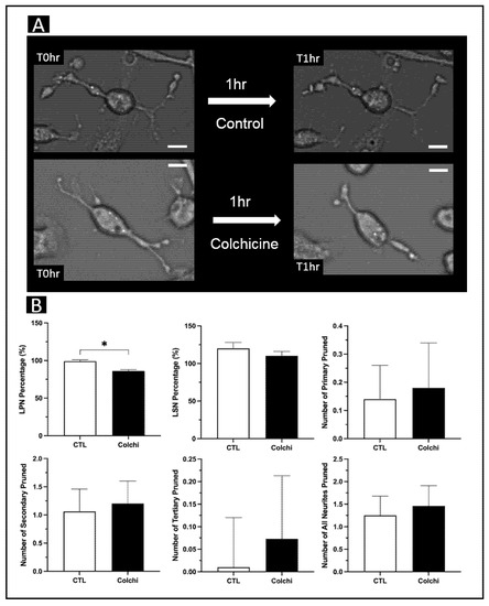Optimization of Neurite Tracing and Further Characterization of Human ...