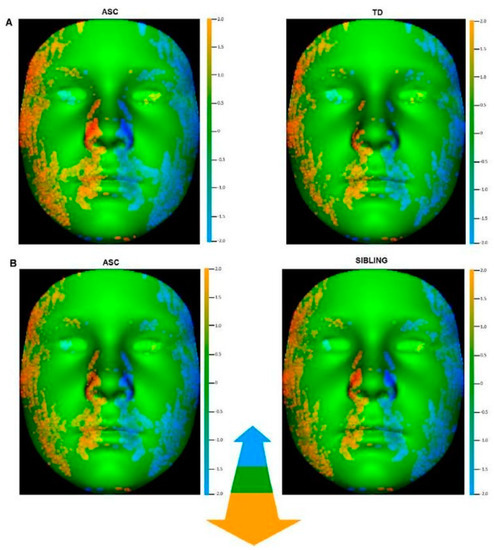 Deep Learning Approach for Screening Autism Spectrum Disorder in ...