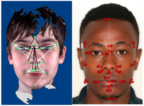 Brain Sciences | Free Full-Text | Deep Learning Approach for Screening ...