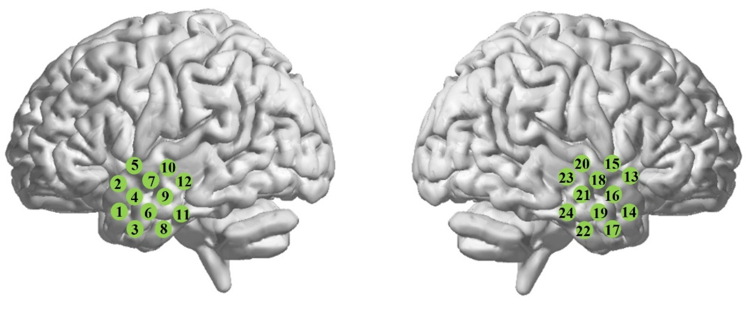 Relationship between Short-Range and Homotopic Long-Range Resting State ...