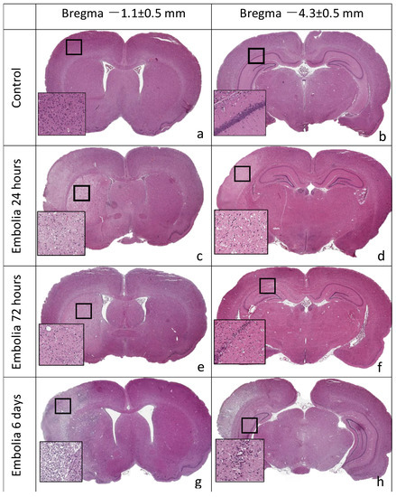 A Novel Thromboplastin-Based Rat Model of Ischemic Stroke