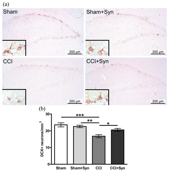 Modulation of Hippocampal Astroglial Activity by Synaptamide in Rats ...