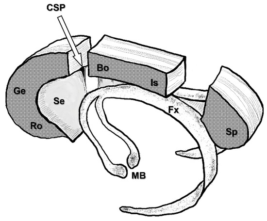 Surgical Aspects of Corpus Callosotomy