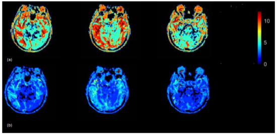 Optimal Scaling Approaches for Perfusion MRI with Distorted Arterial ...