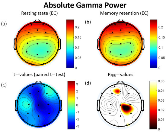 The Functional Interactions between Cortical Regions through Theta ...