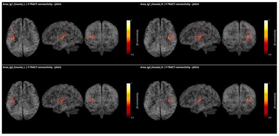Human brain mapping sci journal - mobipsado
