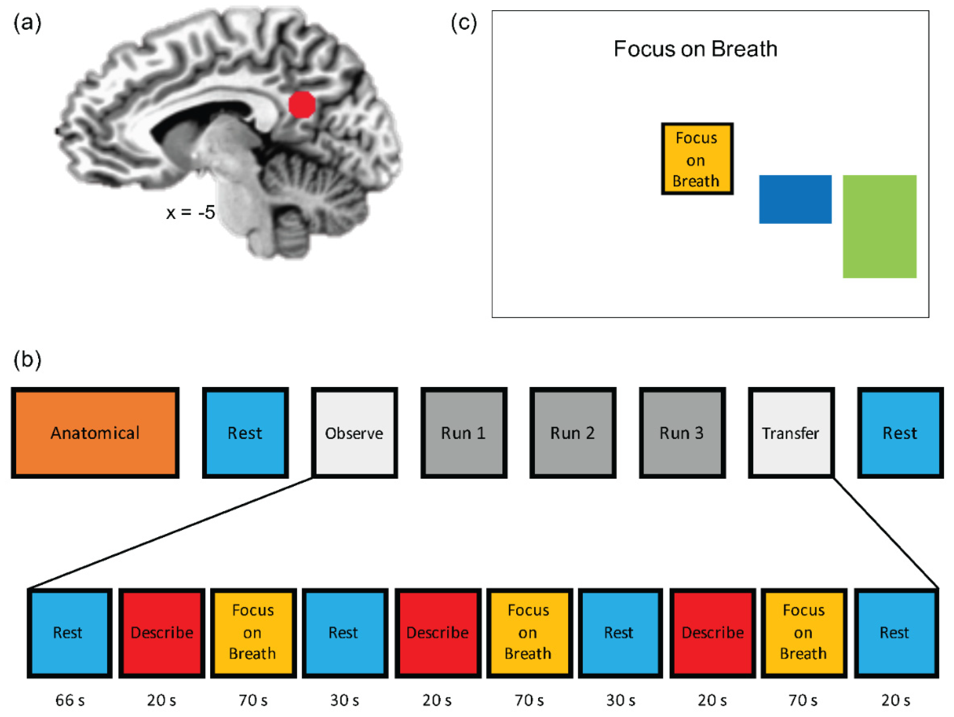 Insular Cortex Fmri