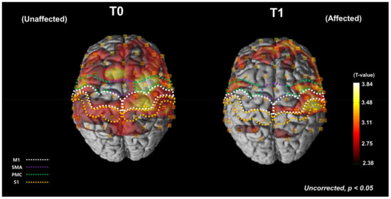 Brain Sciences | An Open Access Journal from MDPI