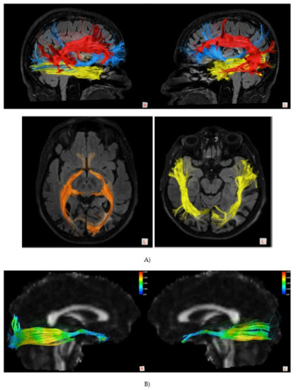 Brain Sciences | An Open Access Journal from MDPI