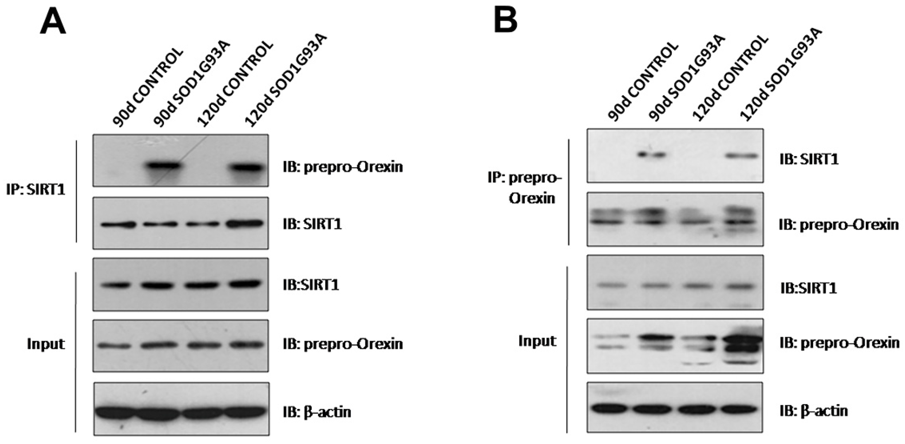 SIRT1 Interacts with Prepro-Orexin in the Hypothalamus in SOD1G93A Mice