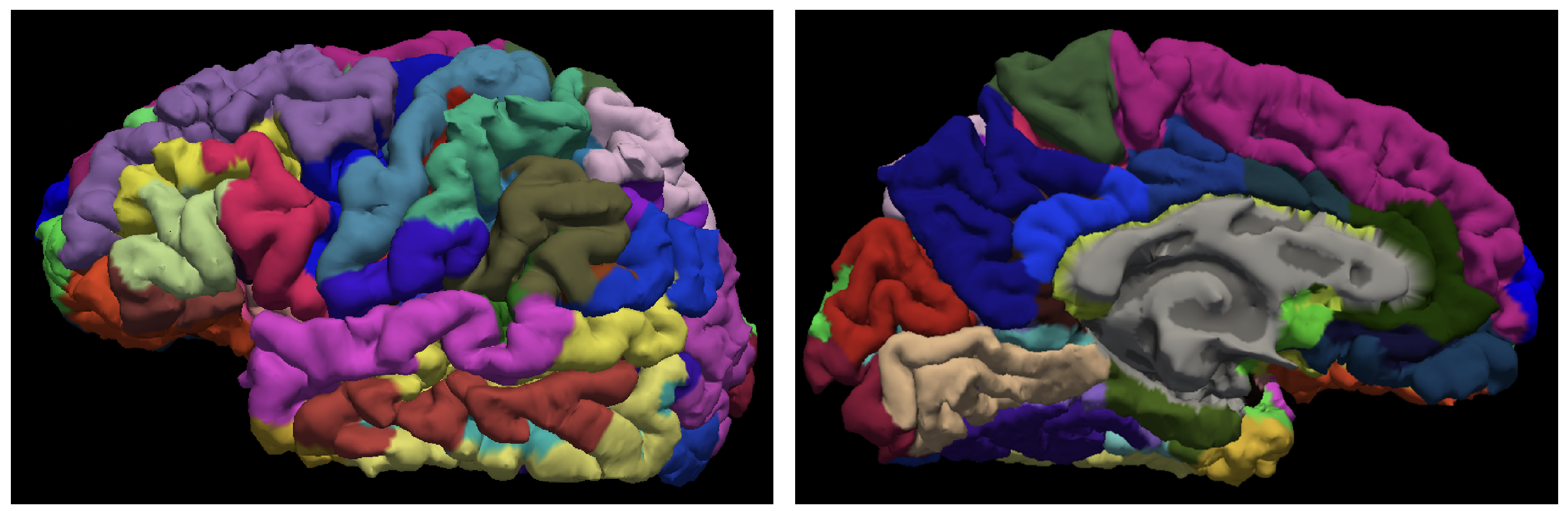 Prediction of Chronological Age in Healthy Elderly Subjects with ...
