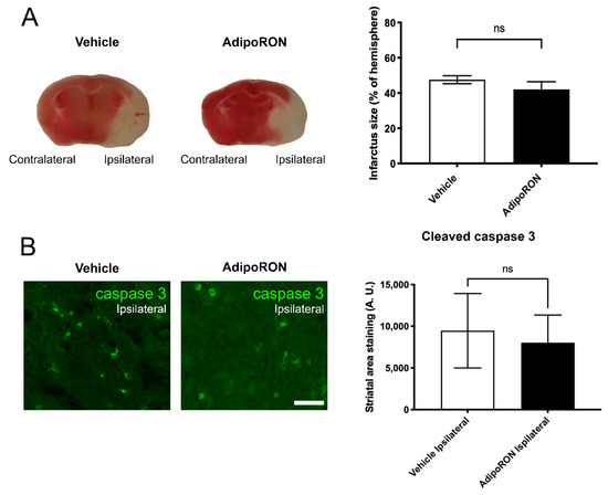 Distribution of Adiponectin Receptors in the Brain of Adult Mouse ...