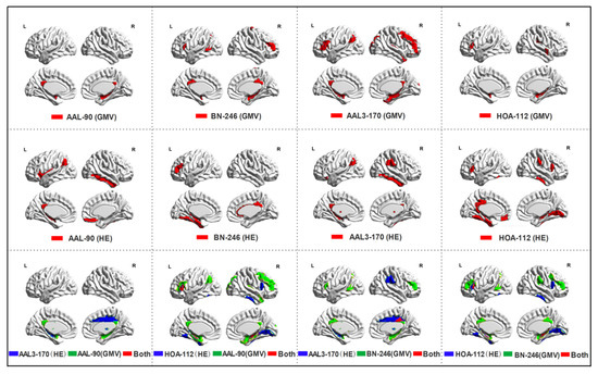 A Multi-Modal and Multi-Atlas Integrated Framework for Identification ...