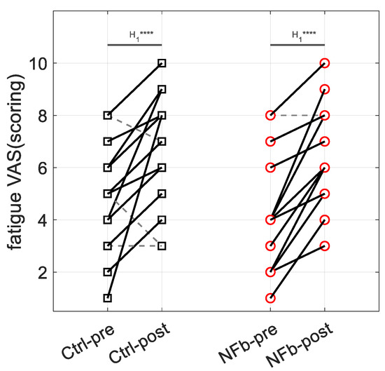 A Single Session of SMR-Neurofeedback Training Improves Selective ...