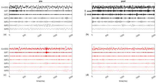 A Single Session of SMR-Neurofeedback Training Improves Selective ...