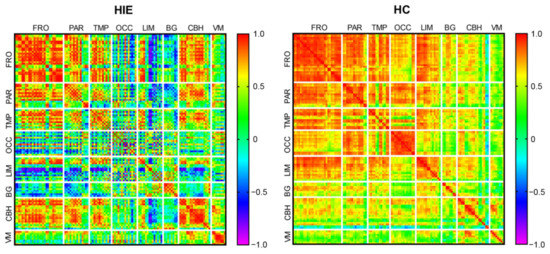 Brain Metabolic Connectivity Patterns in Patients with Prolonged ...