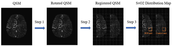 Quantitative Distribution of Cerebral Venous Oxygen Saturation and Its ...