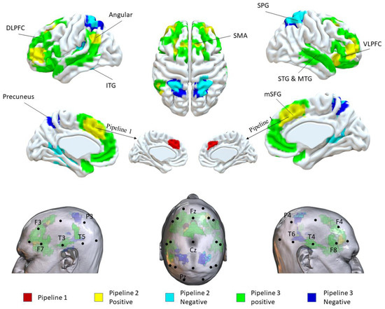 Brain Sciences | Free Full-Text | Potential Targets for Noninvasive ...