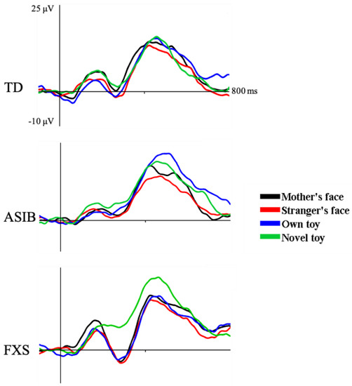 Cortical Source Analysis of the Face Sensitive N290 ERP Component in ...