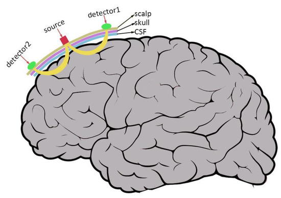 The Effects of Cortical Reorganization and Applications of Functional ...