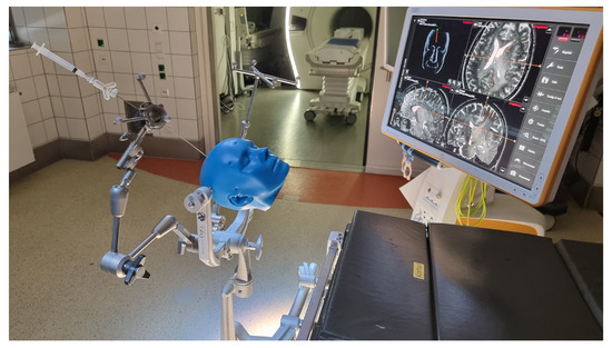 Patient Safety Comparison of Frameless and Frame-Based Stereotactic ...