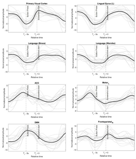 Visualization of the Dynamic Brain Activation Pattern during a Decision ...