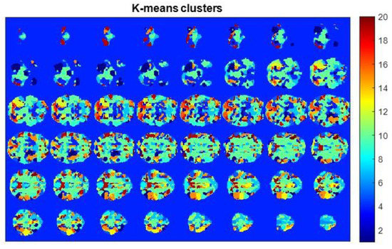 Visualization of the Dynamic Brain Activation Pattern during a Decision ...