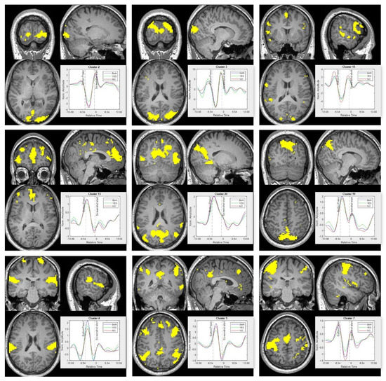 Visualization of the Dynamic Brain Activation Pattern during a Decision ...